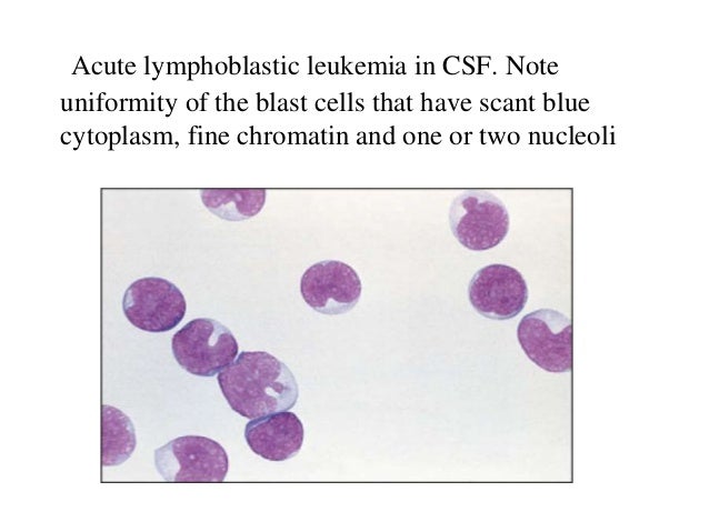 Fluid cytology in CSF