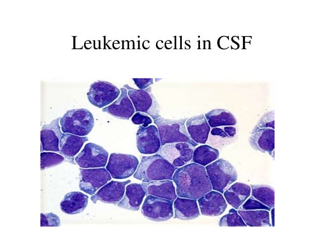 Fluid cytology in CSF