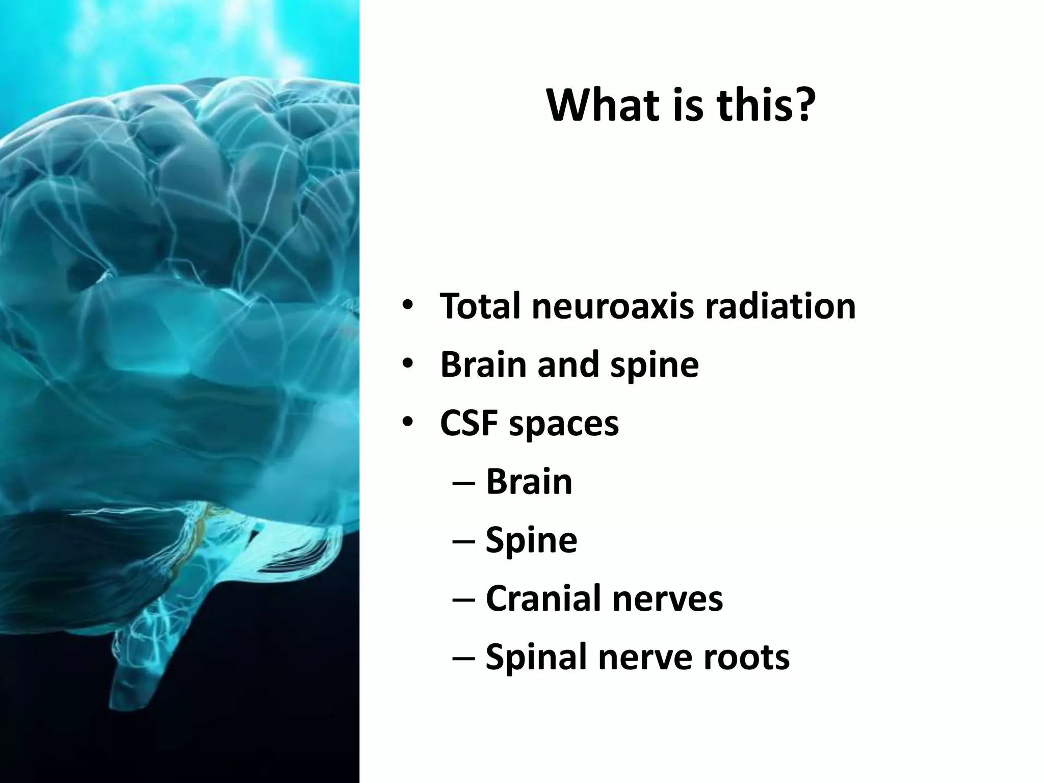 PRACTICALITY OF CRANIOSPINALIRRADIATION | PPTX