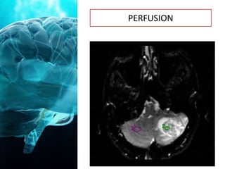 PRACTICALITY OF CRANIOSPINALIRRADIATION | PPTX