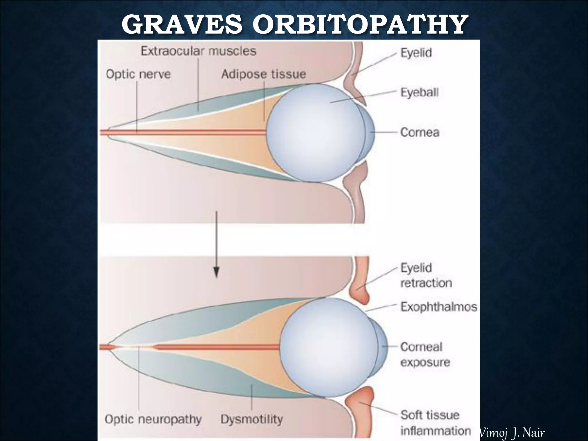 LOW DOSE CRANIOSPINAL IRRADIATION (CSI) USING VMAT , RADIATION FOR ...