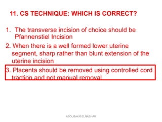 Caesarean Section: An interactive session | PPT