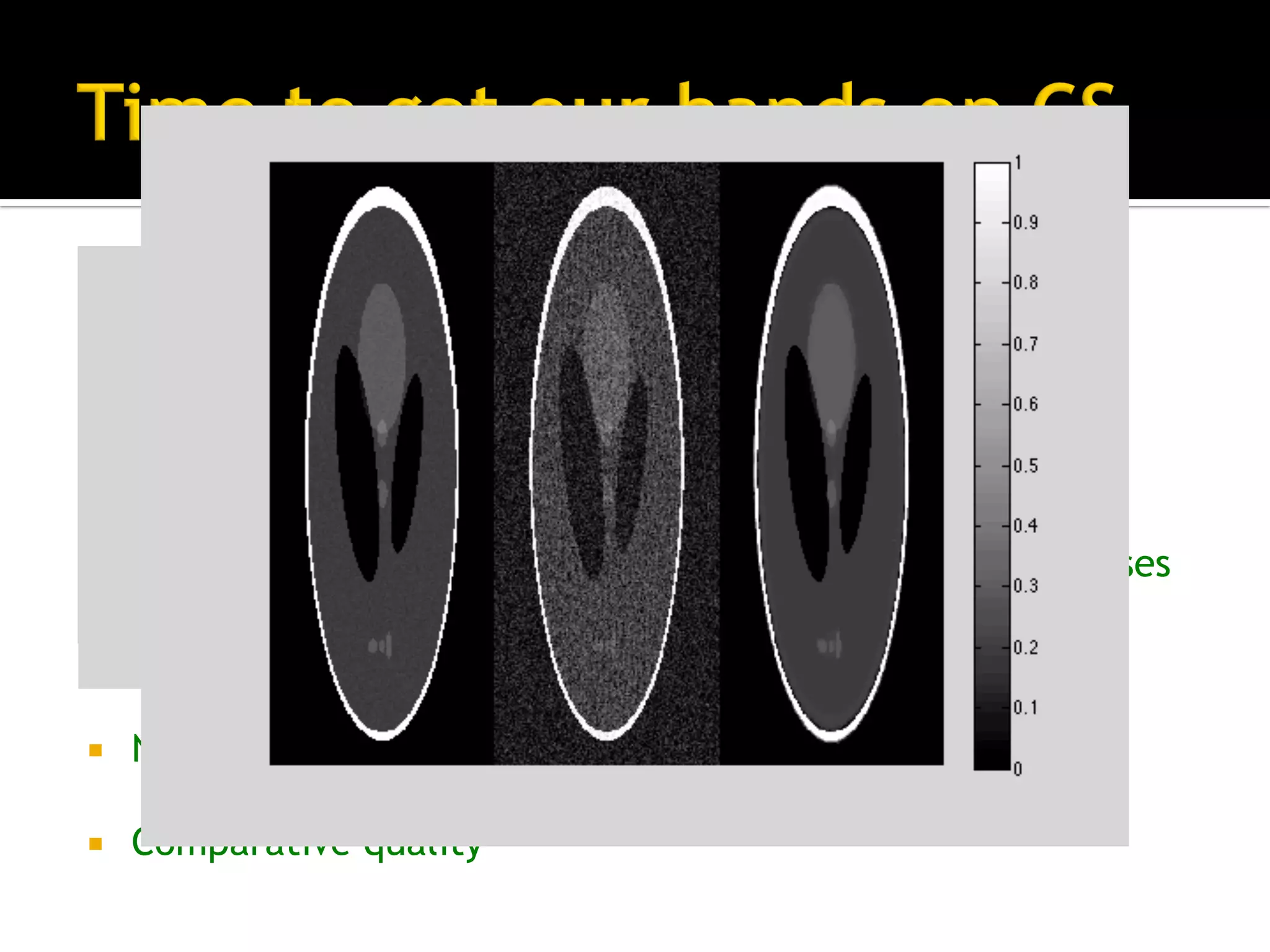 Introduction to compressed sensing MRI | PDF