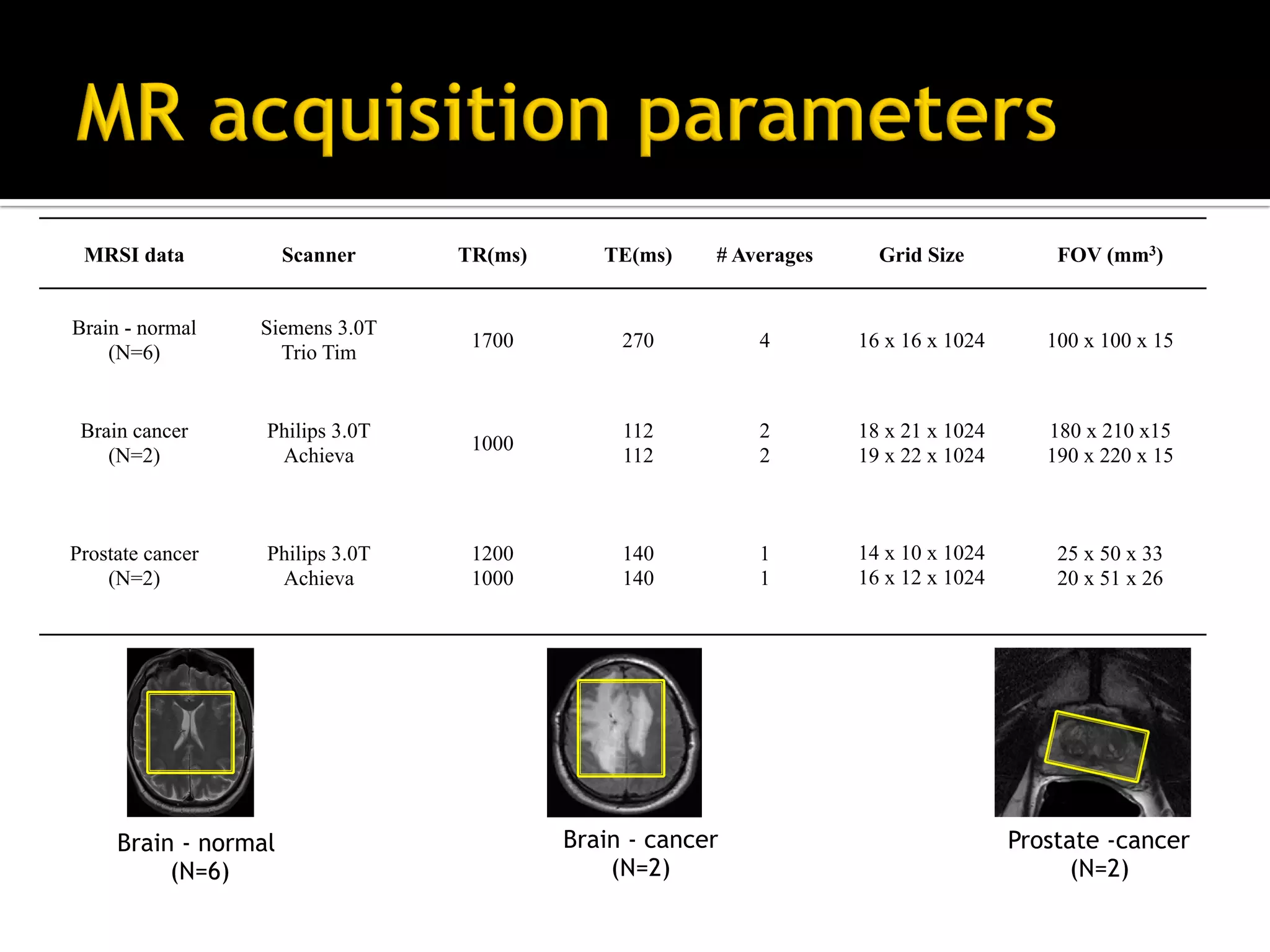 Introduction to compressed sensing MRI | PDF