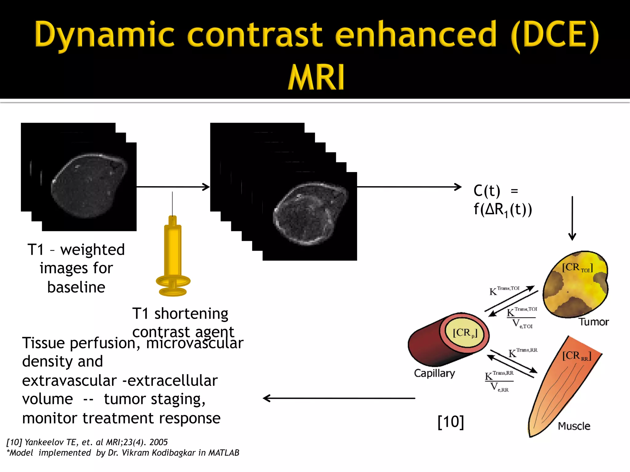 Introduction to compressed sensing MRI | PDF