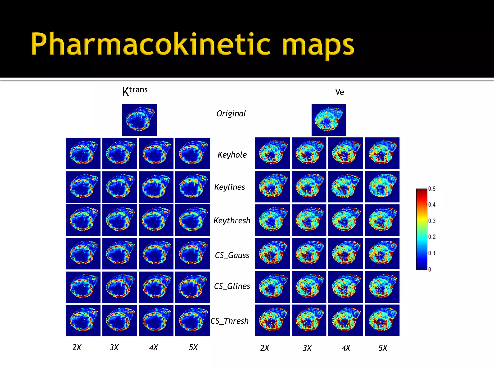 Introduction to compressed sensing MRI | PDF
