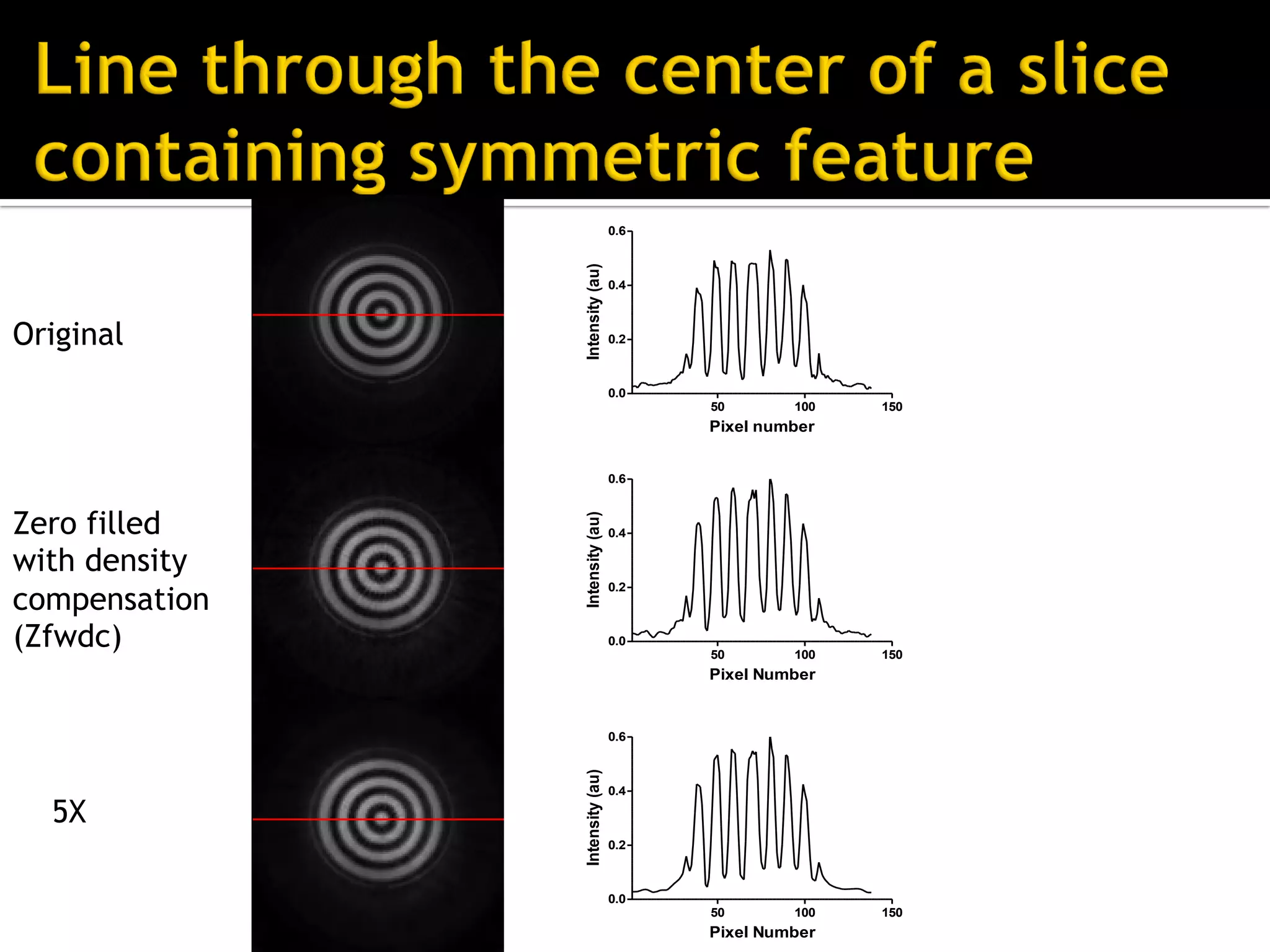 Introduction to compressed sensing MRI | PDF