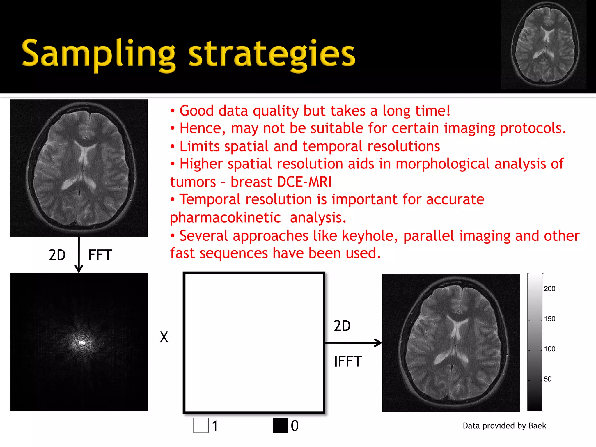 Introduction to compressed sensing MRI | PDF