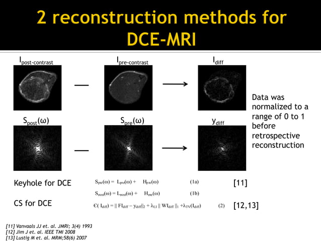 Introduction to compressed sensing MRI | PDF