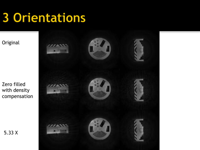 Introduction to compressed sensing MRI | PDF