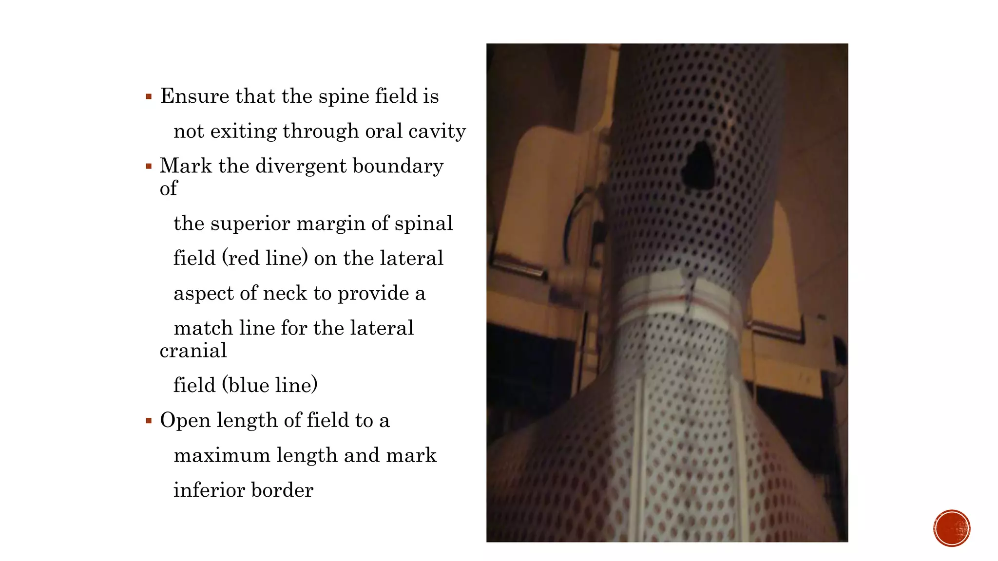 CRANIOSPINAL IRRADIATION-PART 1 | PPTX