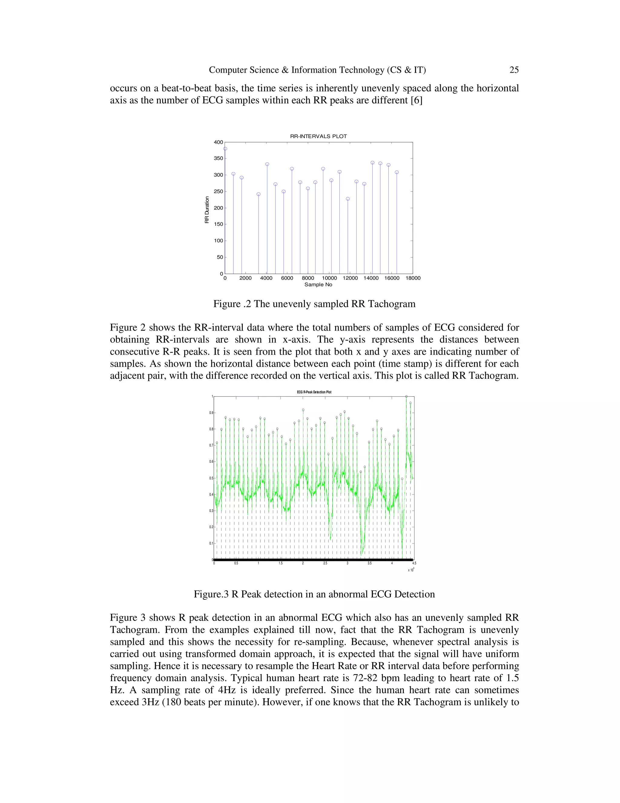 HEART RATE VARIABILITY ANALYSIS FOR ABNORMALITY DETECTION USING TIME FREQUENCY DISTRIBUTION ...