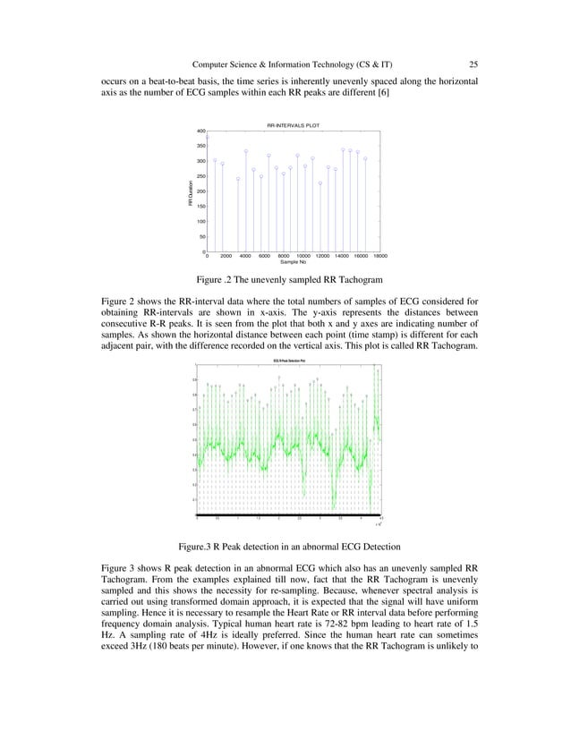 Heart Rate Variability Analysis For Abnormality Detection Using Time