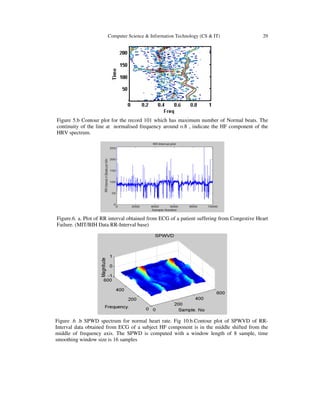 HEART RATE VARIABILITY ANALYSIS FOR ABNORMALITY DETECTION USING TIME FREQUENCY DISTRIBUTION ...