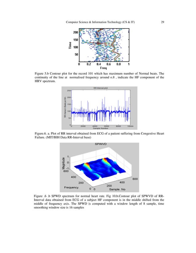 HEART RATE VARIABILITY ANALYSIS FOR ABNORMALITY DETECTION USING TIME FREQUENCY DISTRIBUTION ...