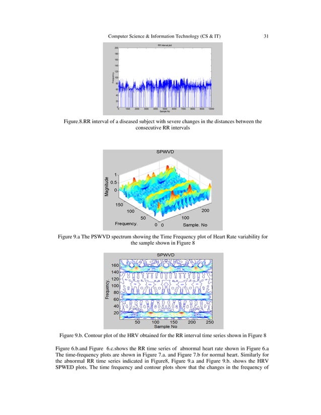 HEART RATE VARIABILITY ANALYSIS FOR ABNORMALITY DETECTION USING TIME FREQUENCY DISTRIBUTION ...