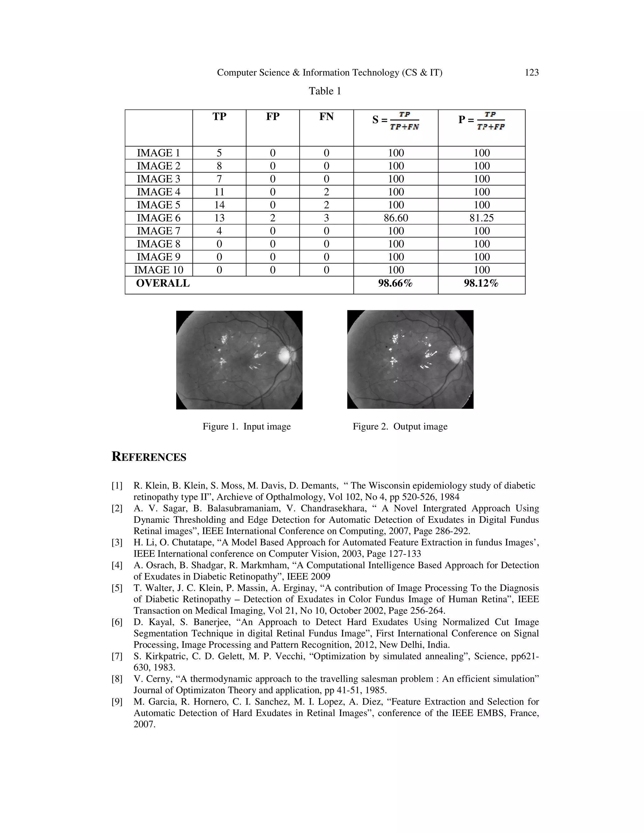 Detection Of Hard Exudates Using Simulated Annealing Based Thresholding