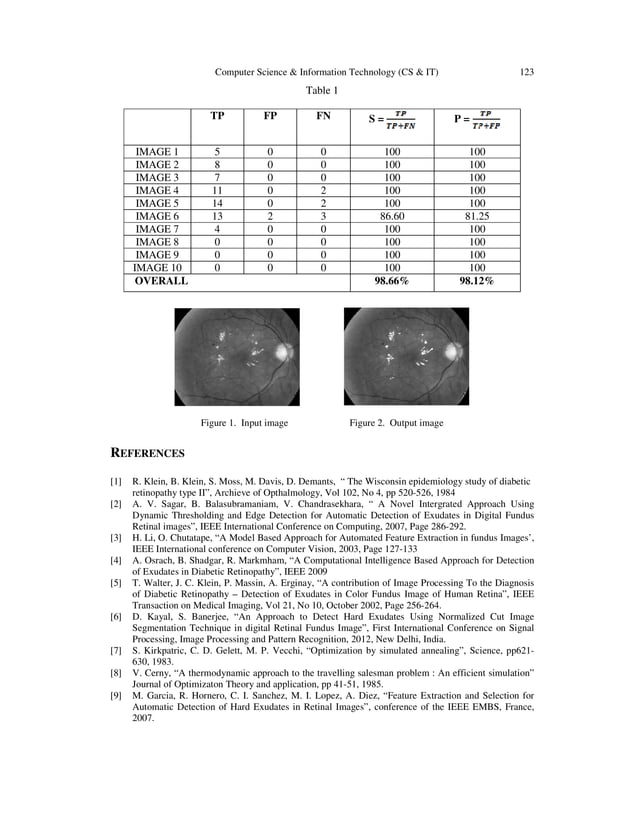 DETECTION OF HARD EXUDATES USING SIMULATED ANNEALING BASED THRESHOLDING ...