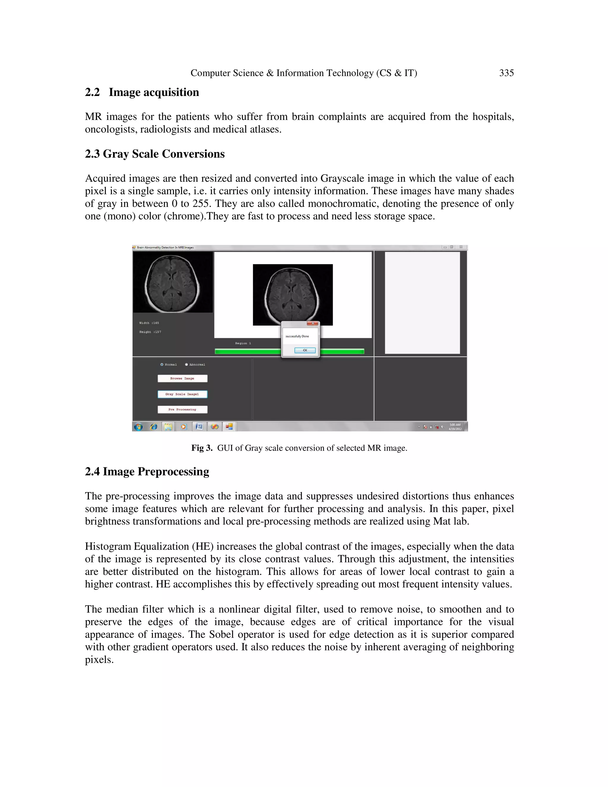 An Ann Based Brain Abnormality Detection Using Mr Images Pdf