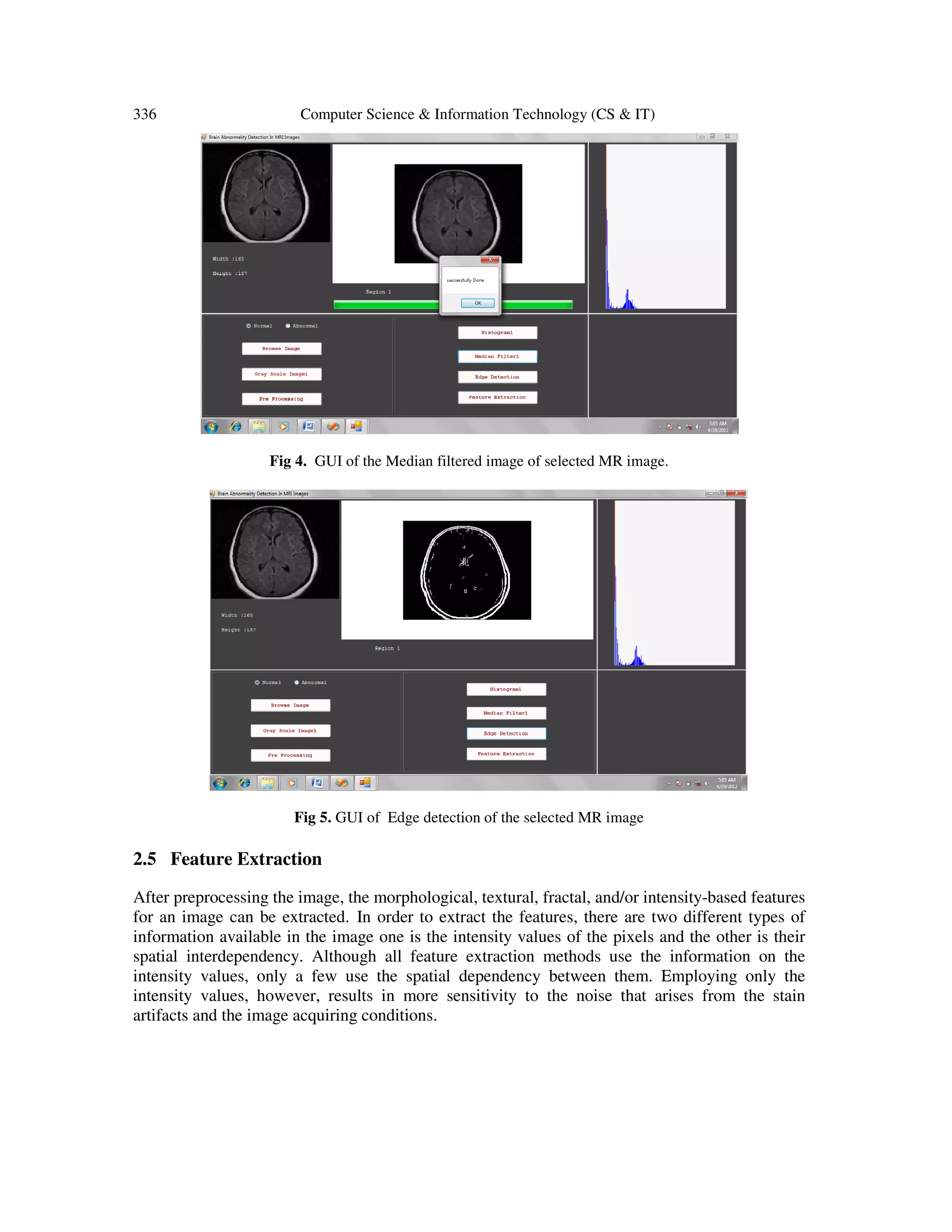 An Ann Based Brain Abnormality Detection Using Mr Images Pdf