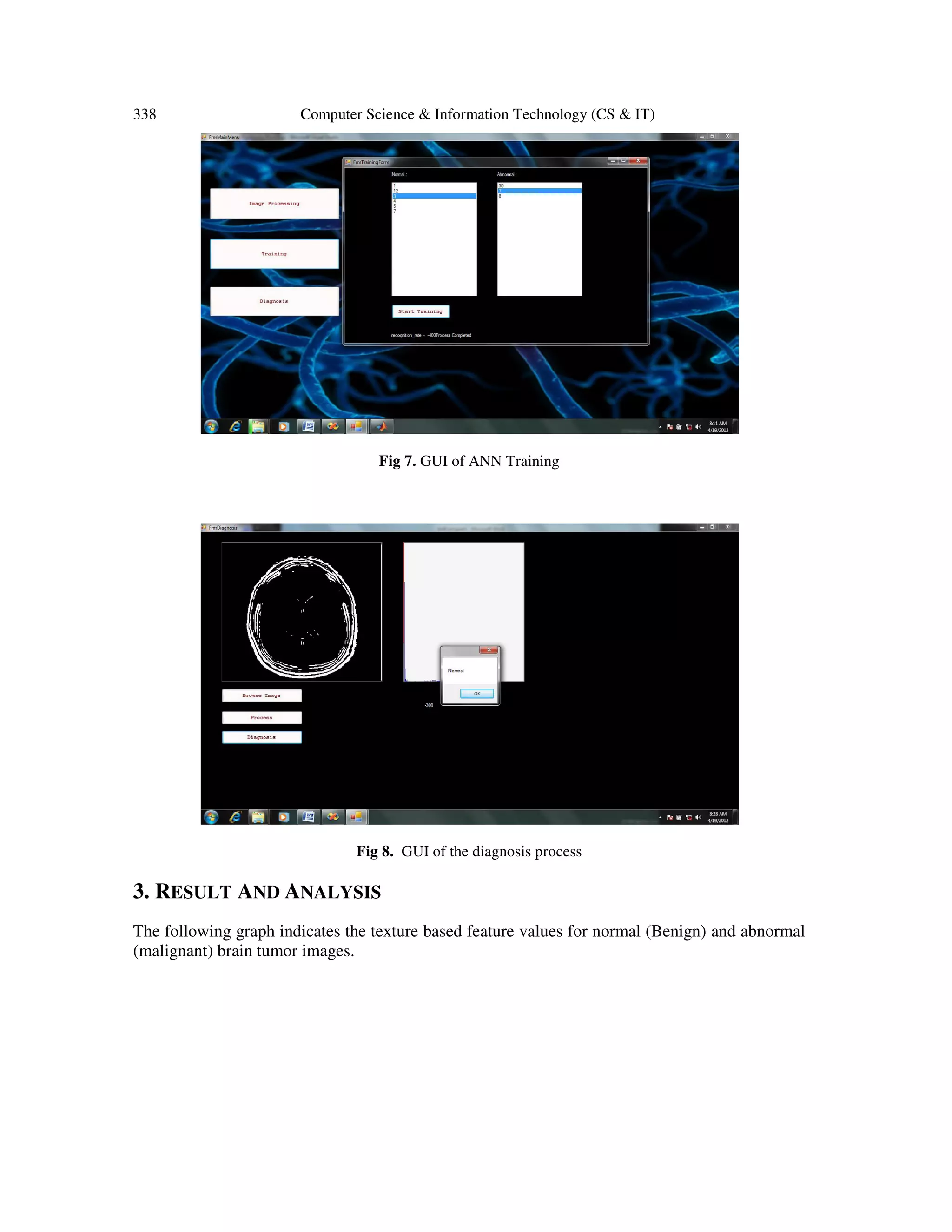 An Ann Based Brain Abnormality Detection Using Mr Images Pdf