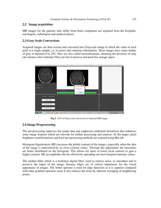 AN ANN BASED BRAIN ABNORMALITY DETECTION USING MR IMAGES | PDF