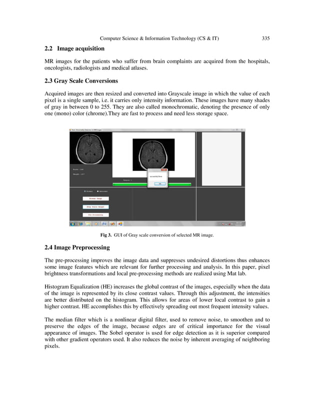 AN ANN BASED BRAIN ABNORMALITY DETECTION USING MR IMAGES | PDF