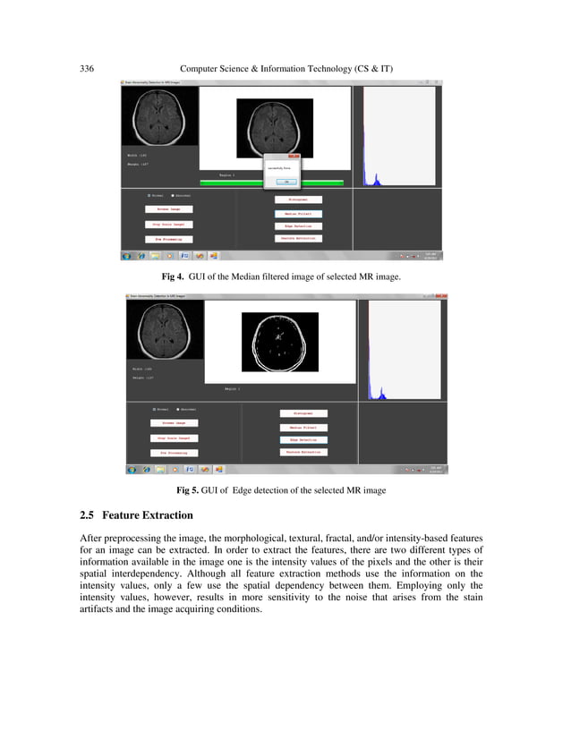 An Ann Based Brain Abnormality Detection Using Mr Images Pdf