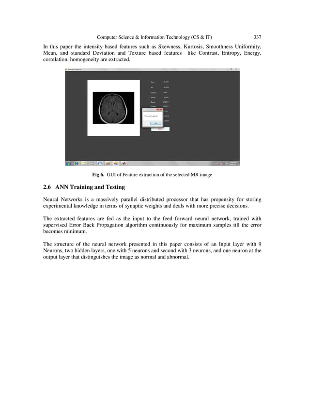 An Ann Based Brain Abnormality Detection Using Mr Images Pdf