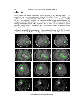 GPU-BASED IMAGE SEGMENTATION USING LEVEL SET METHOD WITH SCALING ...