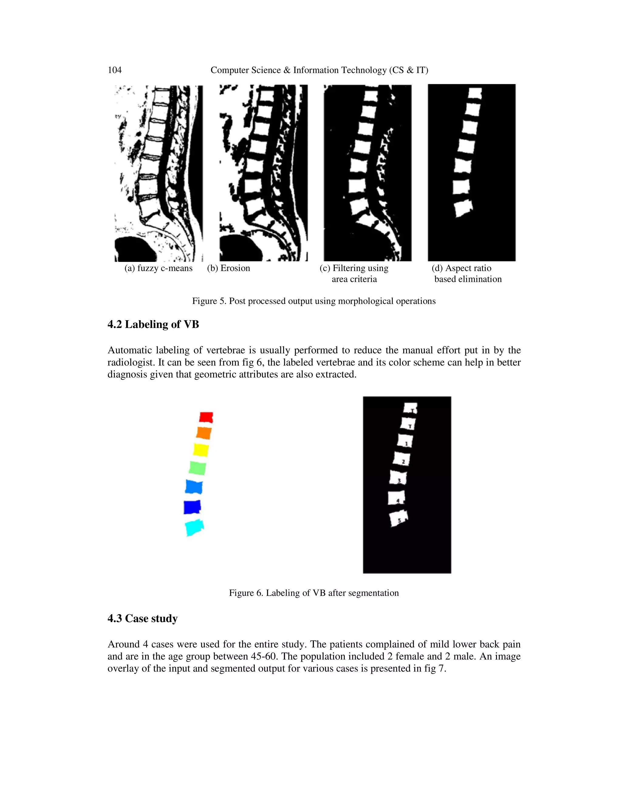 SEGMENTATION AND LABELLING OF HUMAN SPINE MR IMAGES USING FUZZY CLUSTERING | PDF