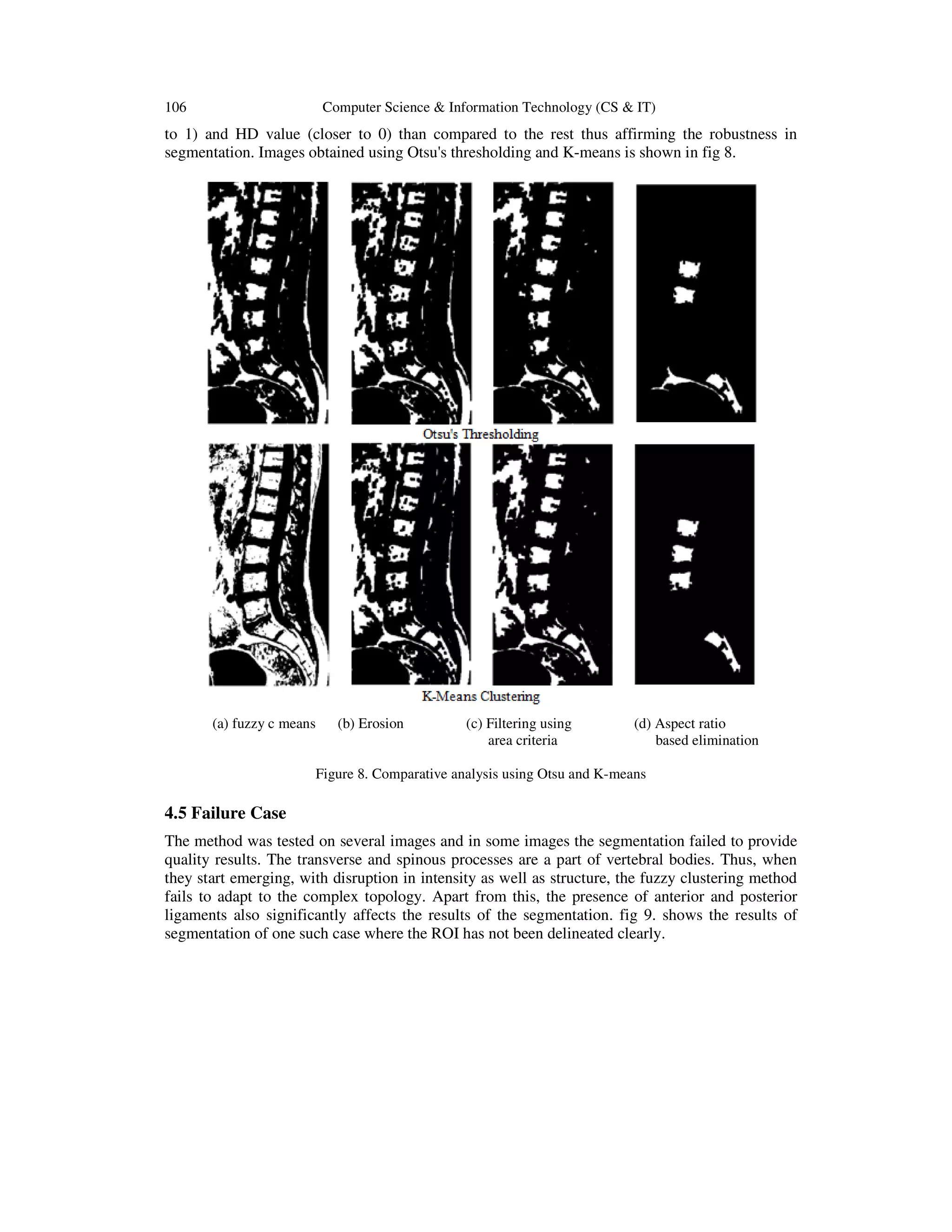 SEGMENTATION AND LABELLING OF HUMAN SPINE MR IMAGES USING FUZZY CLUSTERING | PDF