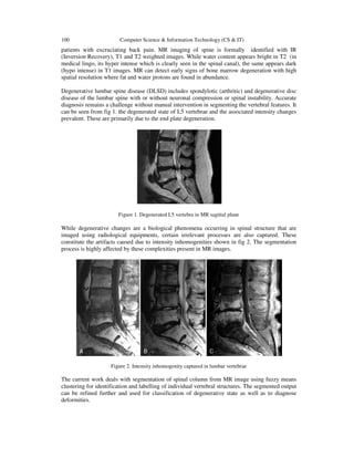 SEGMENTATION AND LABELLING OF HUMAN SPINE MR IMAGES USING FUZZY CLUSTERING | PDF
