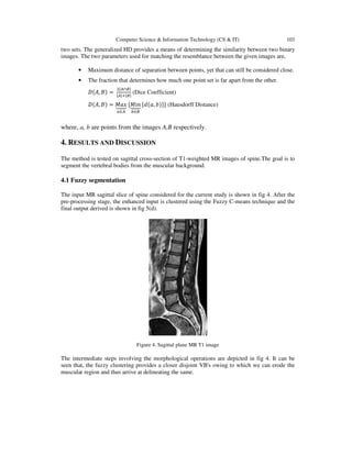 SEGMENTATION AND LABELLING OF HUMAN SPINE MR IMAGES USING FUZZY CLUSTERING | PDF