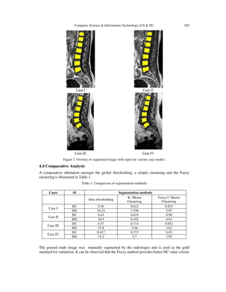 SEGMENTATION AND LABELLING OF HUMAN SPINE MR IMAGES USING FUZZY CLUSTERING | PDF