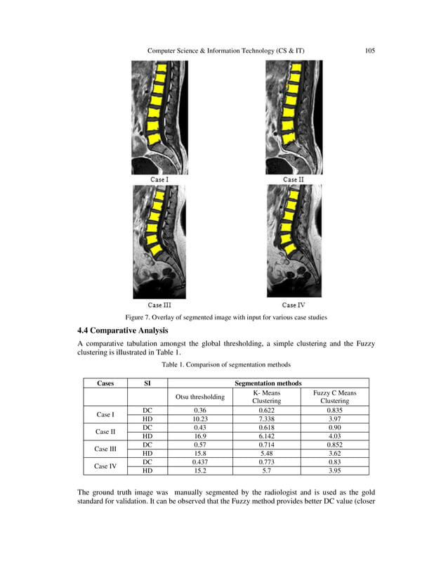 SEGMENTATION AND LABELLING OF HUMAN SPINE MR IMAGES USING FUZZY CLUSTERING | PDF