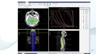 IMPLEMENTATION OF CRANIOSPINAL IRRADIATION (CSI) WITH POSTERIOR FOSSA ...