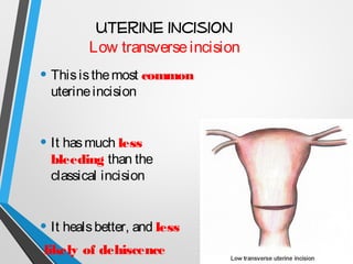Cesarean Section - CS | PPT