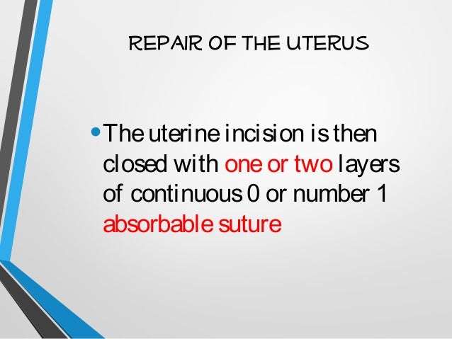 Cesarean Section - CS