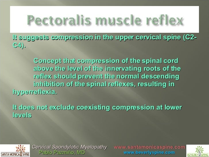 Ligamentation Flavum Buckling
