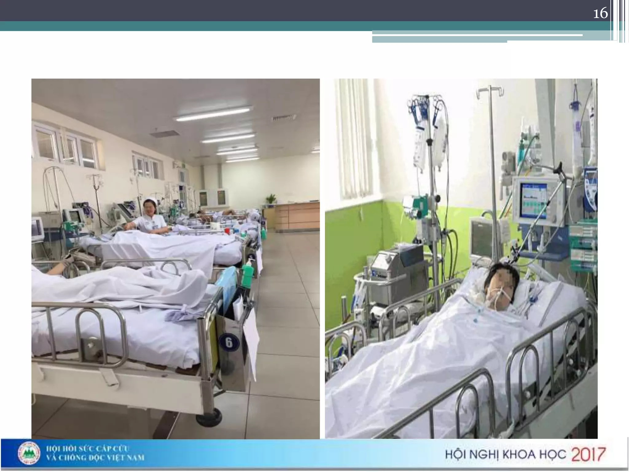 CSNB THỞ MÁY.pptx