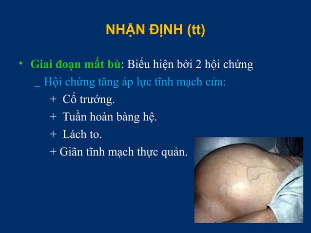 Csnb xơ gan | PPT