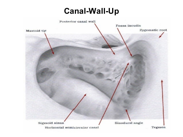 Csom aa, 10.04.17, s.s.bakshi