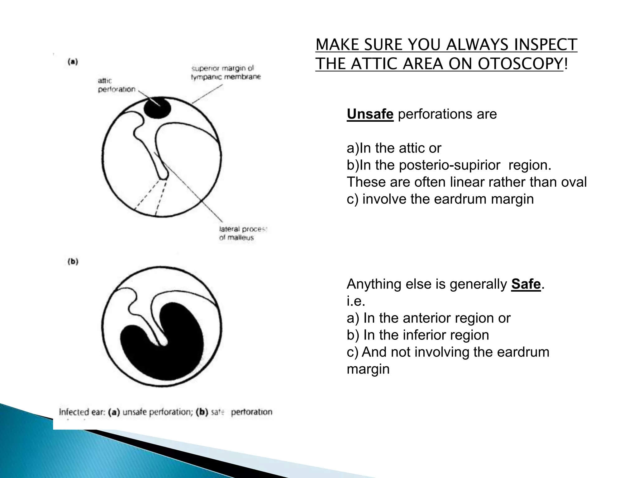 Csom a practical approach | PPTX | Ear, Nose and Throat Conditions ...