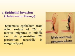 Chronic suppurative otitis media | PPTX