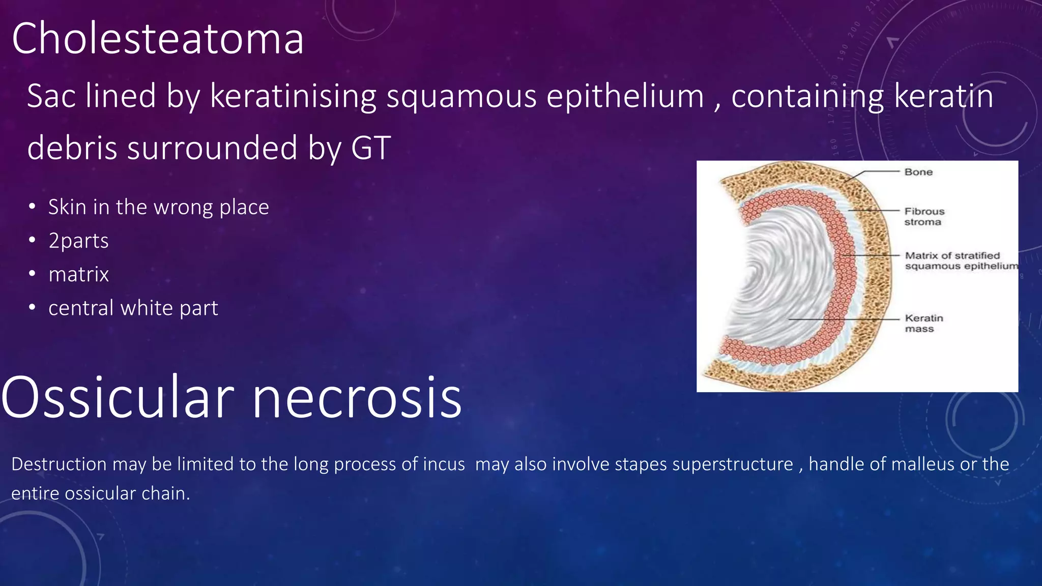 CSOM atticoantral.pptx