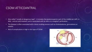 CSOM atticoantral.pptx