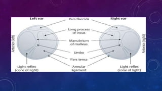 CSOM atticoantral.pptx