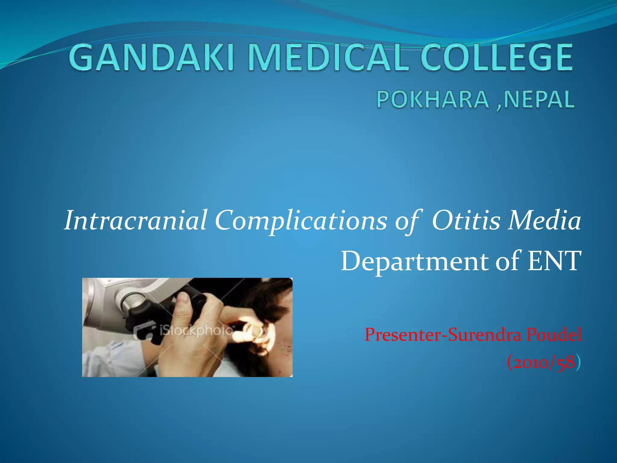 Otitis media intracranial complications | PPTX