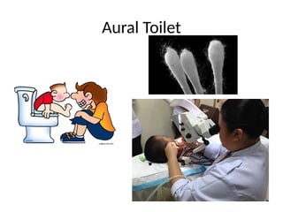 Chronic Suppurative Otitis Media - Tubo-Tympanic type | PPTX